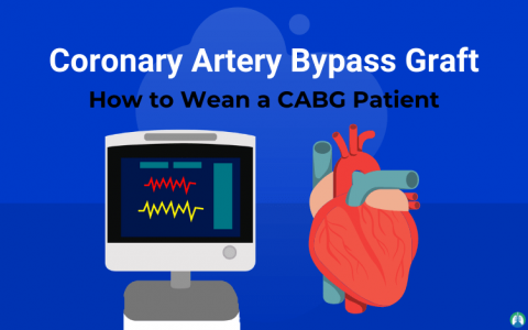 How to Wean a CABG Patient (Coronary Artery Bypass Graft)