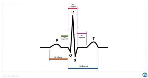 EKG Interpretation: Overview and Practice Questions