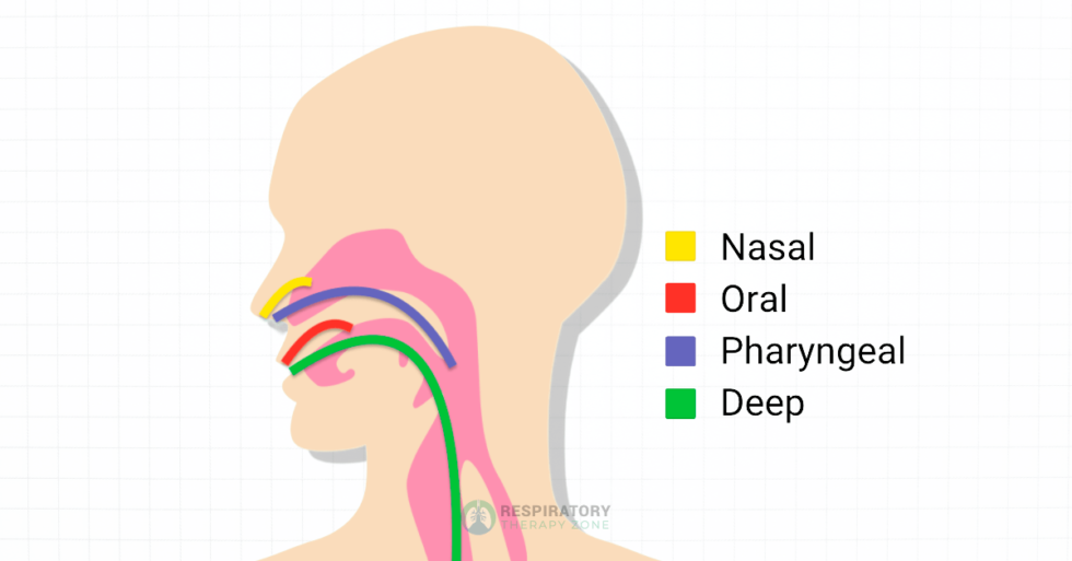 Airway Suctioning: Overview and Practice Questions (2023)