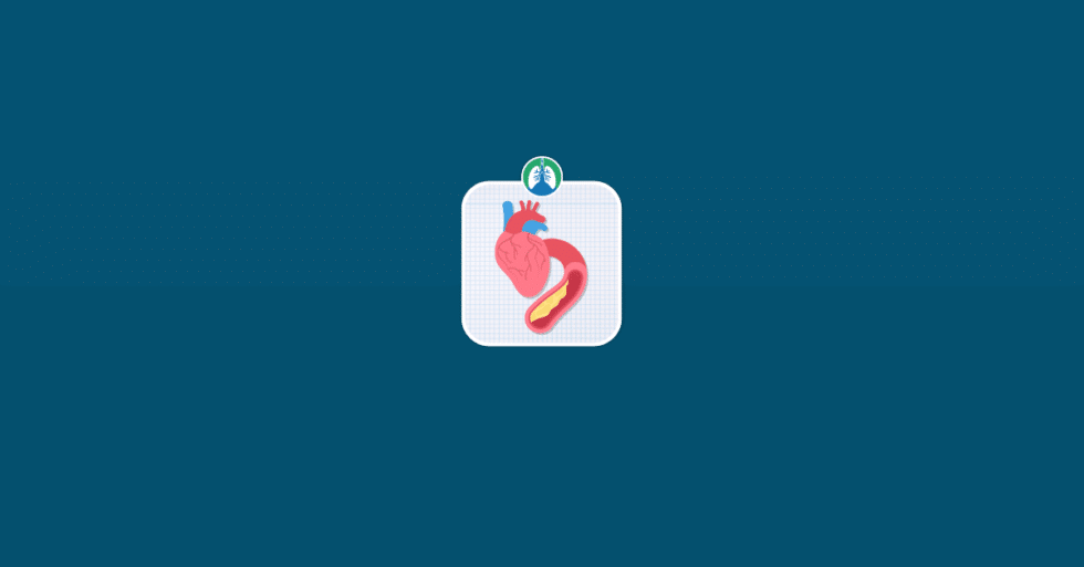 Ventilator Weaning After Coronary Artery Bypass Graft (CABG)