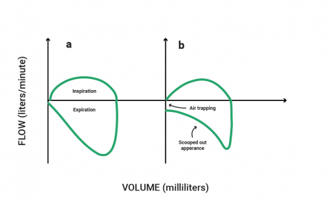 Ventilator Waveforms and Graphics: An Overview (2025)