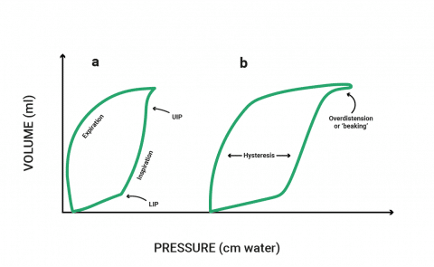Ventilator Waveforms and Graphics: An Overview (2025)