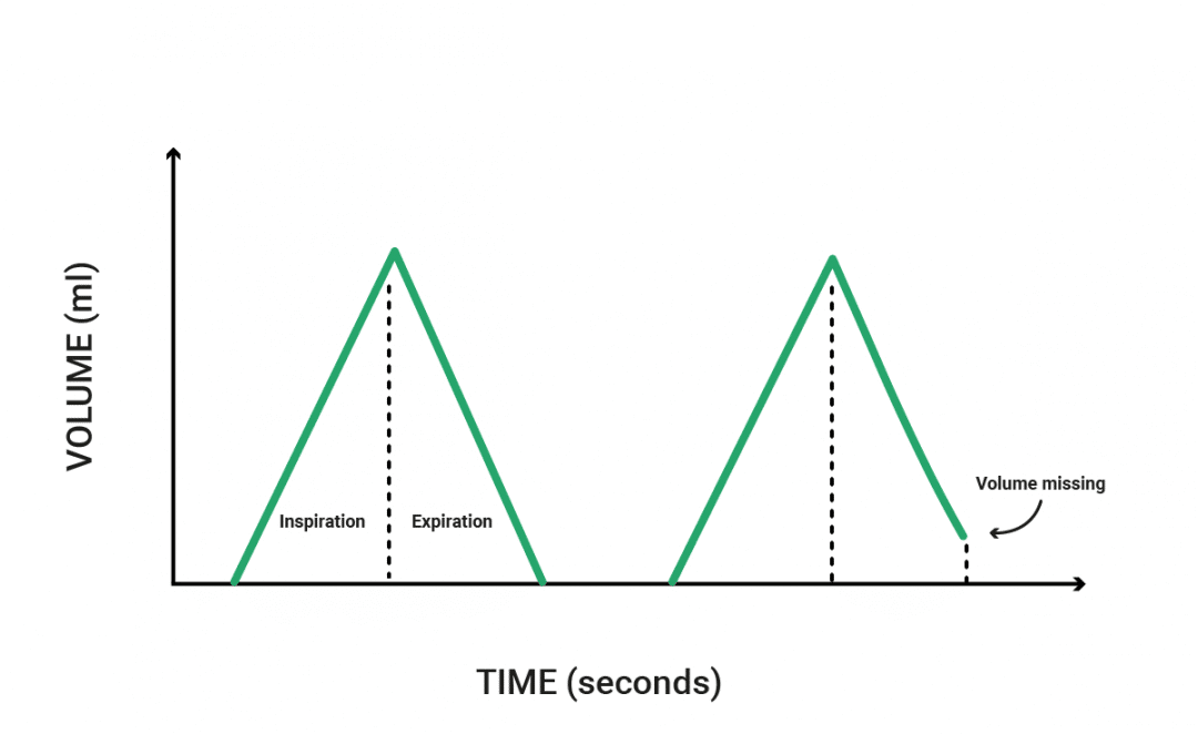 Ventilator Waveforms and Graphics Made EASY (Overview)