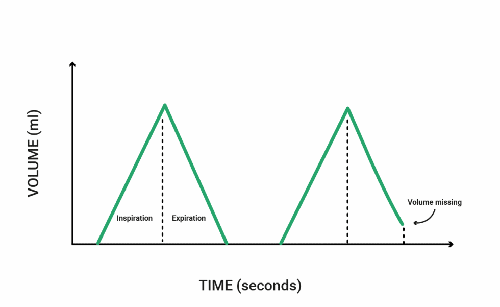 Ventilator Waveforms And Graphics An Overview 2025