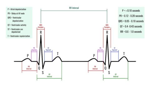 Depolarization vs. Repolarization of the Heart (2025)