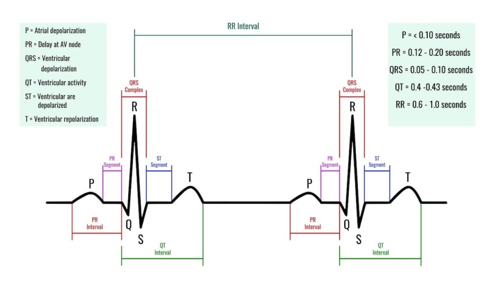 Depolarization vs. Repolarization of the Heart (2025)