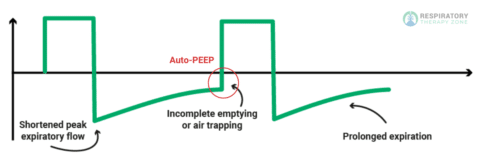 Auto-PEEP: Complication of Mechanical Ventilation (2023)
