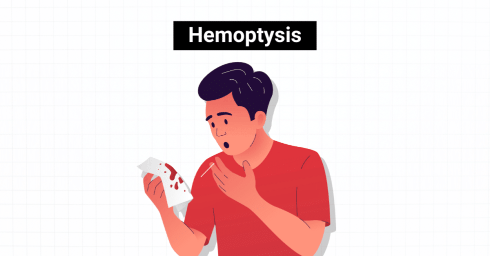 Hemoptysis: Overview and Practice Questions (2025)