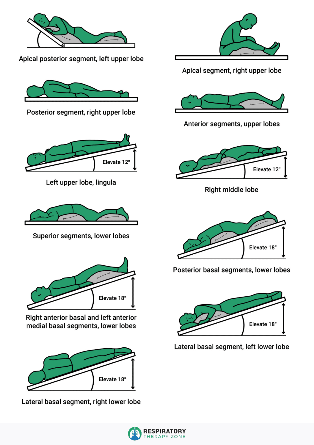 Postural Drainage Positions and Chest Physical Therapy (CPT)