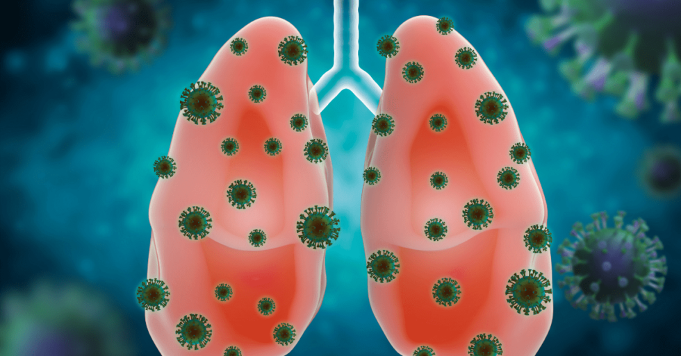Can COVID 19 Cause COPD 2026 