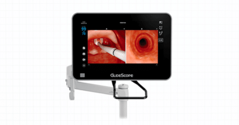 GlideScope Intubation: An Overview (2025)
