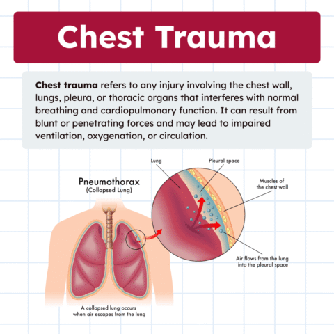 Chest Trauma: Overview and Practice Questions (2026)