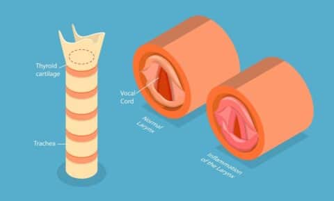 Tracheal Disorders: Types, Symptoms, and Treatment (2025)