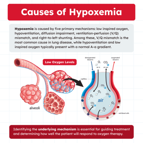 Causes of Hypoxemia: Why Blood Oxygen Levels Drop (2026)