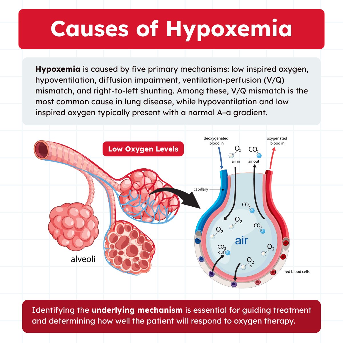 Causes of Hypoxemia: Why Blood Oxygen Levels Drop (2026)