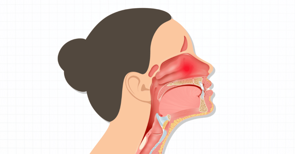 Why Does My Nose Burn? (2026)