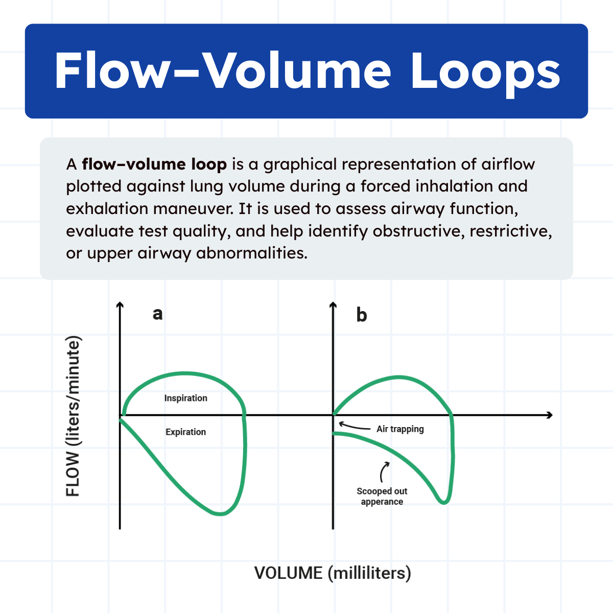Spirometry: Overview and Practice Questions (2026)