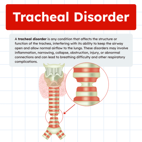Tracheal Disorders: Types, Symptoms, and Treatment (2026)