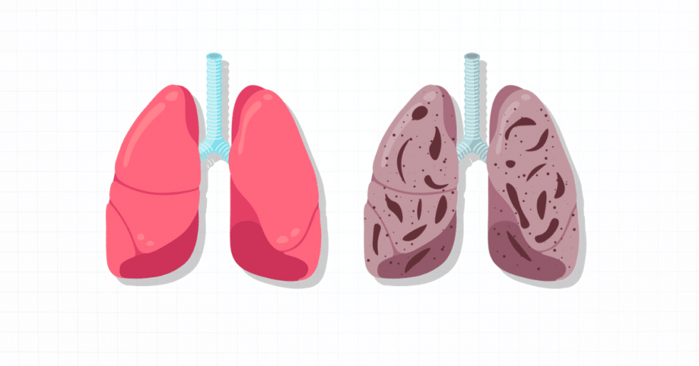 Top 13+ Warning Signs of Lung Damage (2025)