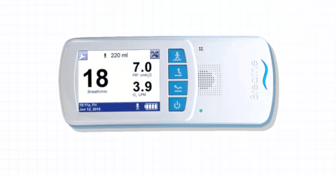 Life2000 Ventilator: Features and Clinical Uses (2026)
