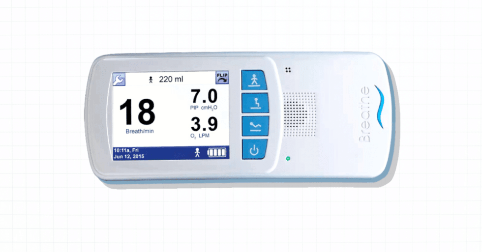 Life2000 Ventilator: Features and Clinical Uses (2026)