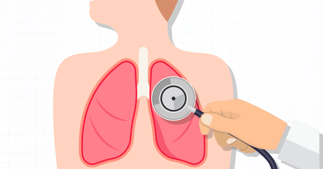 Can You Hear Pneumonia with a Stethoscope? (2024)