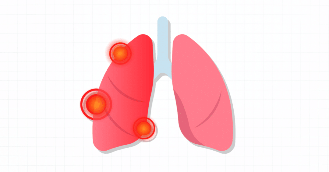 Why are My Lungs Burning? (2024)