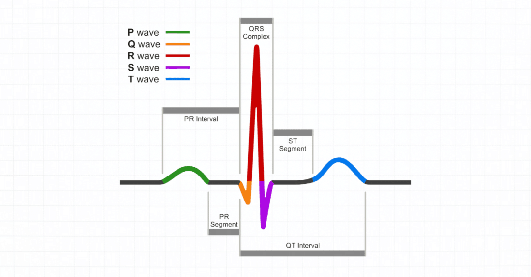 EKG Interpretation: Overview and Practice Questions (2024)