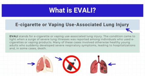 E-cigarette or Vaping Use-Associated Lung Injury (EVALI)