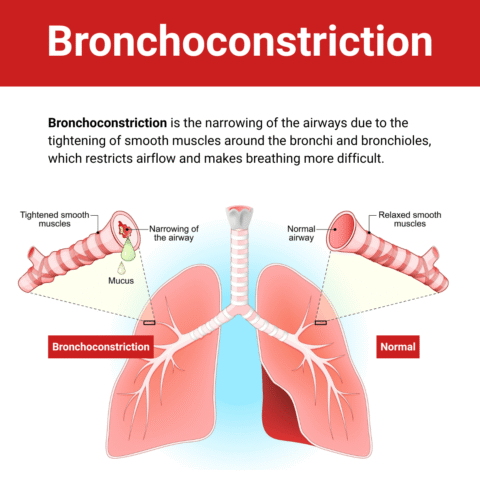 Bronchoconstriction: Overview and Practice Questions (2026)