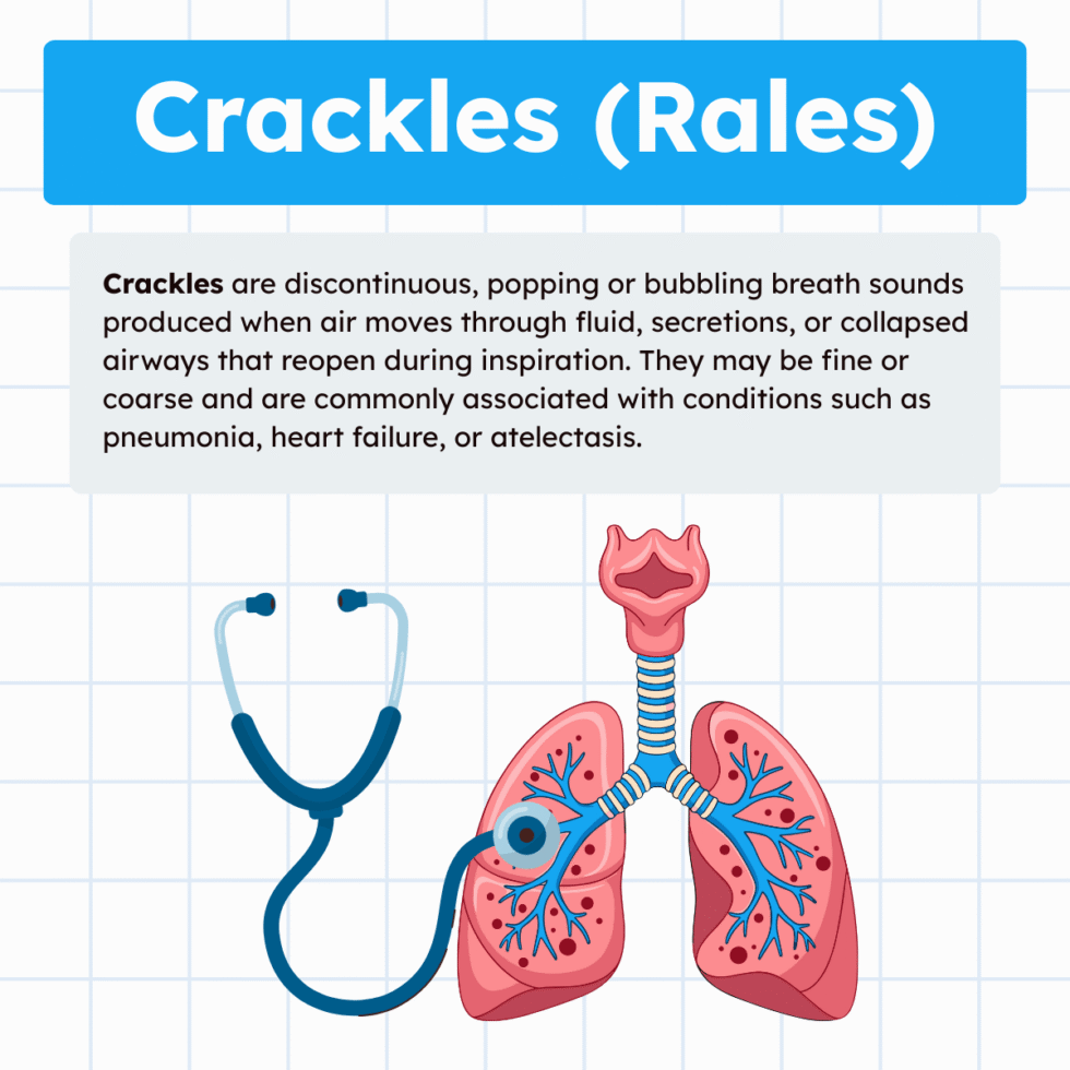Crackles (Lung Sounds): Overview and Practice Questions