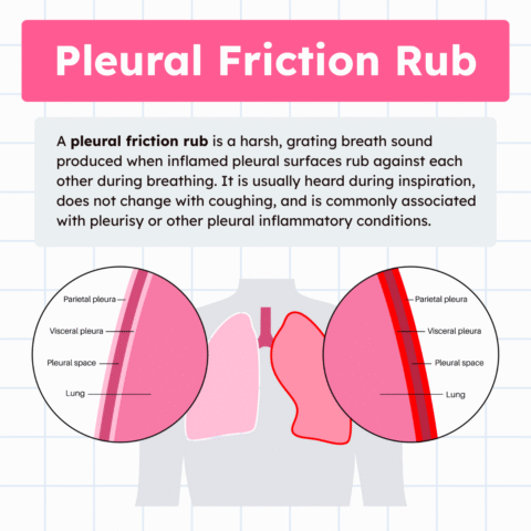 Pleural Friction Rub: Overview and Practice Questions (2026)