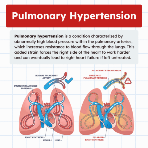 Pulmonary Hypertension: Overview and Practice Questions