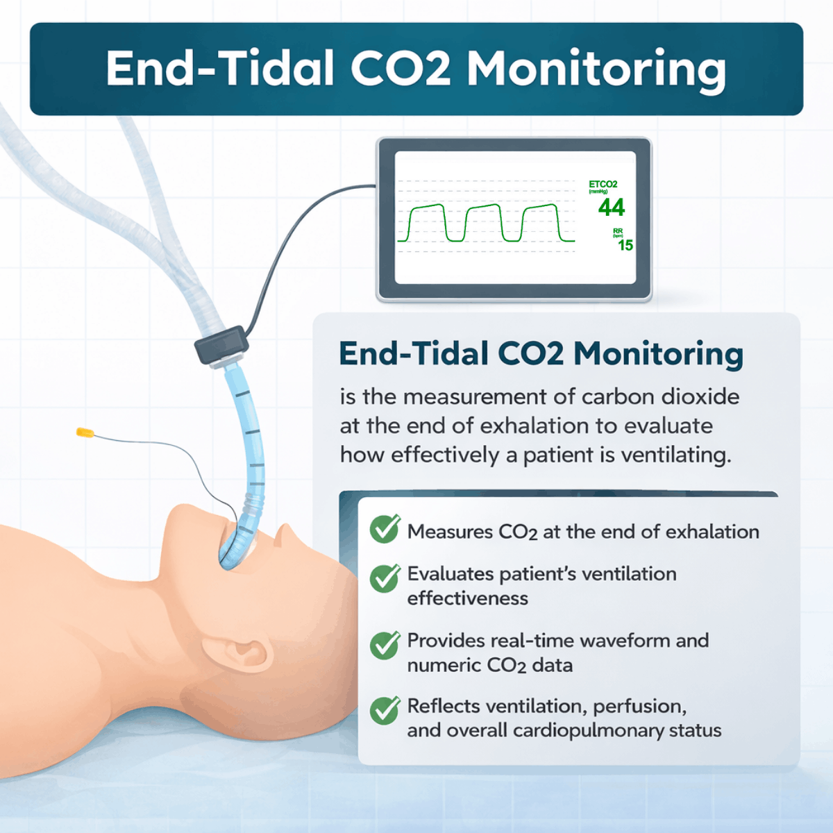 End-Tidal CO2 Monitoring in Respiratory Care (2026)