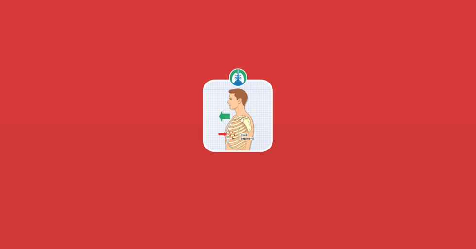 Flail Chest: Causes, Treatment, and Management (2026)