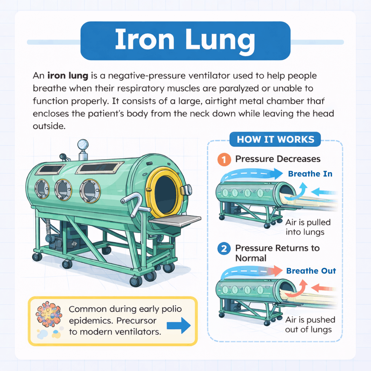 Iron Lung: History, Function, and Medical Impact (2026)