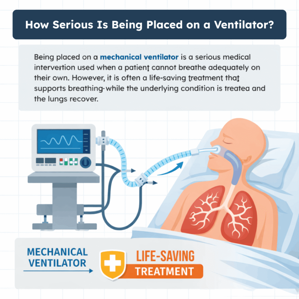 How Serious Is Being Put on a Ventilator? (2026)