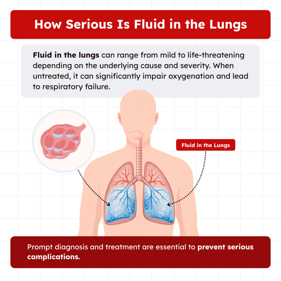 How Serious Is Fluid in the Lungs? (2026)