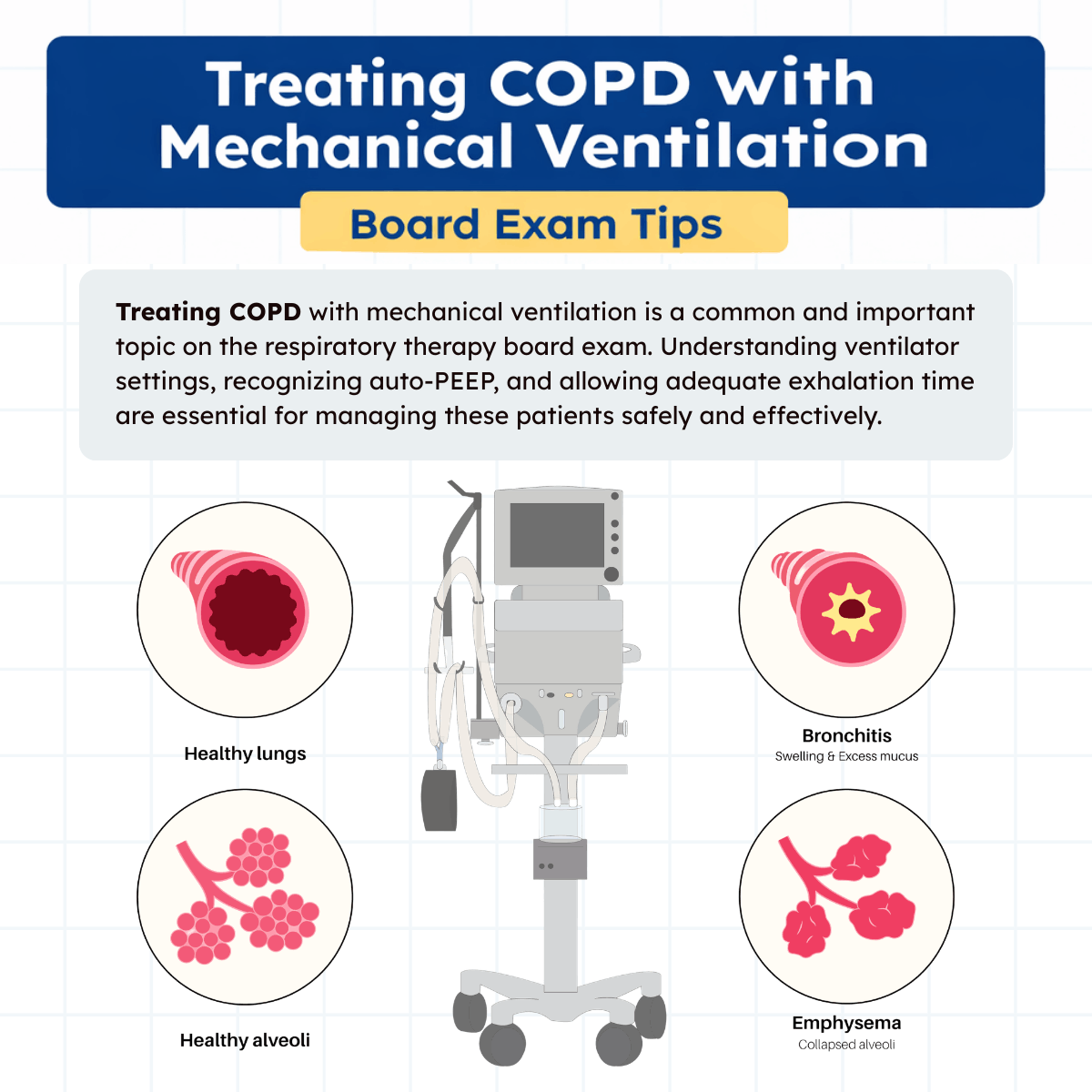 Treating COPD with Mechanical Ventilation: Board Exam Tips