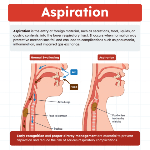 Aspiration in Respiratory Care: Causes and Prevention (2026)
